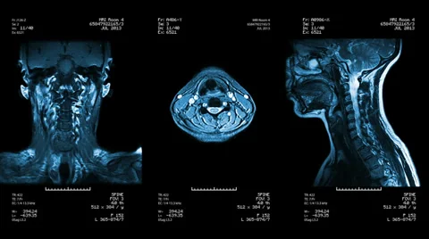 Neck MRI scan. Loopable. Blue. | Stock Video | Pond5