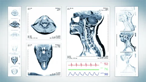 Neck MRI Scan. White. 3 in 1. Top, front... | Stock Video | Pond5