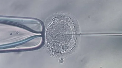 Needle puncture of human egg and sperm i... | Stock Video | Pond5