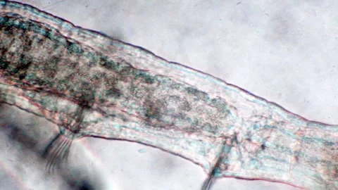 nematoda, intestine of nematode under th... | Stock Video | Pond5