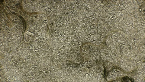 Nematoda Stock Video Footage | Royalty Free Nematoda Videos | Pond5