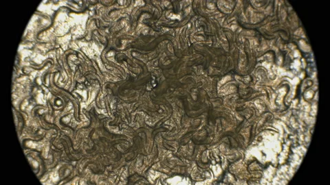 Nematoda Stock Video Footage | Royalty Free Nematoda Videos | Pond5