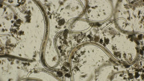 nematoda worm colony, | Stock Video | Pond5