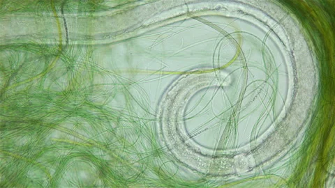 Nematoda worm under a microscope, worm m... | Stock Video | Pond5