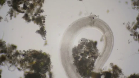 Nematode under the microscope in 4k | Stock Video | Pond5