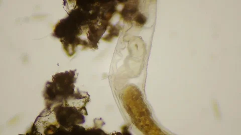 Nematode under the microscope in 4k | Stock Video | Pond5