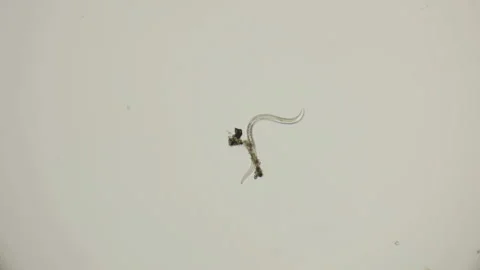 the nematode worm under a microscope | Stock Video | Pond5