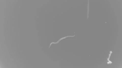 the nematode worm under a microscope | Stock Video | Pond5