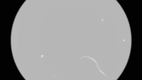 the nematode worm under a microscope | Stock Video | Pond5