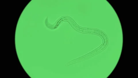 the nematode worm under a microscope | Stock Video | Pond5