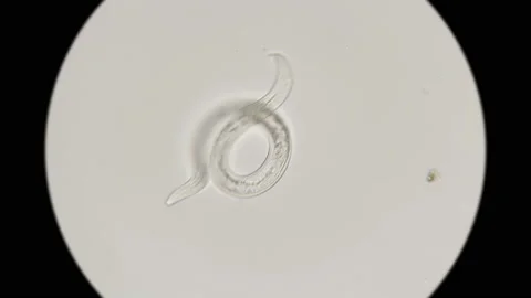 the nematode worm under a microscope | Stock Video | Pond5