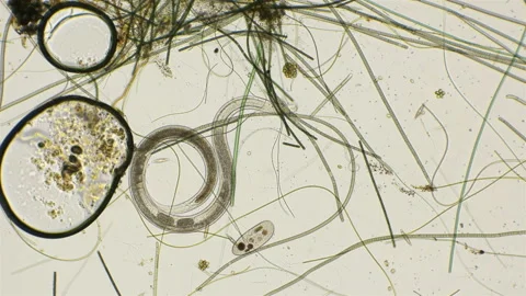 the nematode worm under a microscope | Stock Video | Pond5