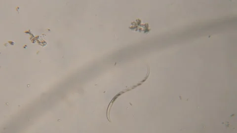 Nematode Worm Under Microscope, Parasite... | Stock Video | Pond5