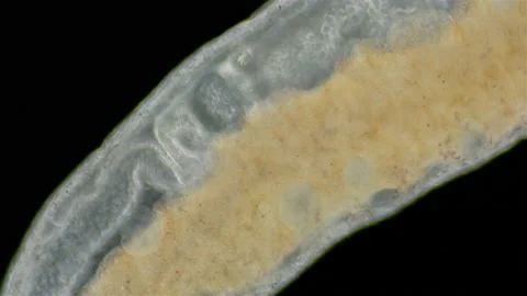 Nemertea worm under a microscope, class ... | Stock Video | Pond5