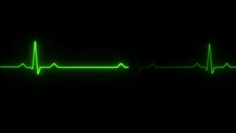 neon ecg line animation video on black b... | Stock Video | Pond5
