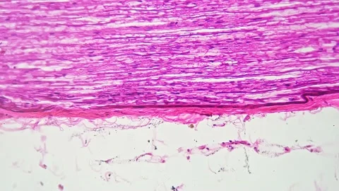 Nerves trunk in longitudinal section fil... | Stock Video | Pond5