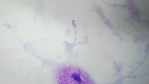 Neurolink system. Motor neuron under a m... | Stock Video | Pond5
