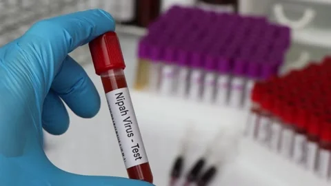 Nipah virus test to look for abnormaliti... | Stock Video | Pond5