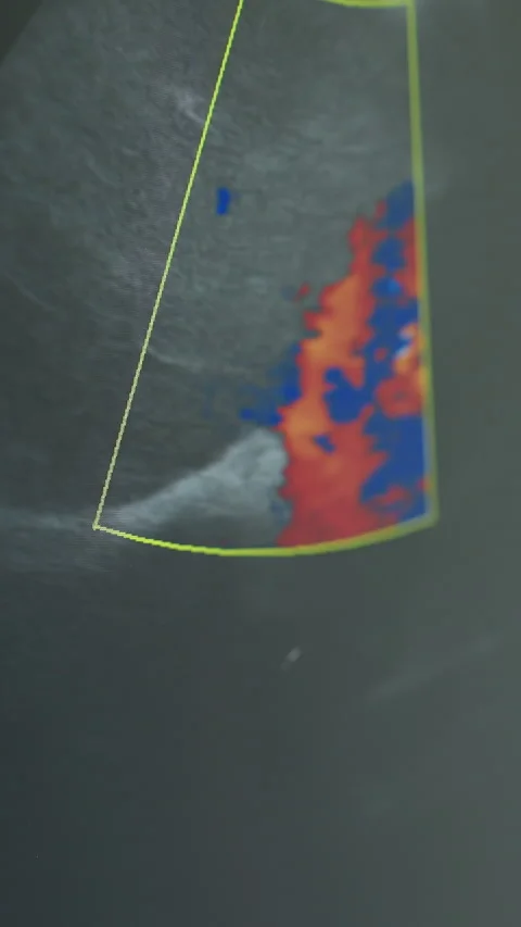 Liver Blood Flow Stock Videos – Royalty-Free HD & 4K Videos