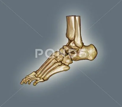 Normal foot, 3d ct scan: Graphic #11177549