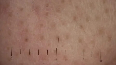 Nose skin under microscope | Stock Video | Pond5