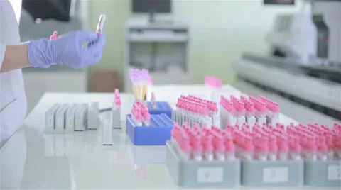 Test Tube Blood Stock Videos – Royalty-Free HD & 4K Videos