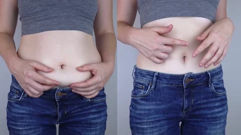 Obesity Cellulite. Folds of excess fat o... | Stock Video | Pond5