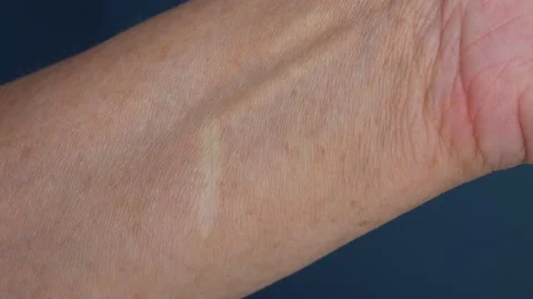 Scar Texture Stock Video Footage | Royalty Free Scar Texture Videos | Pond5