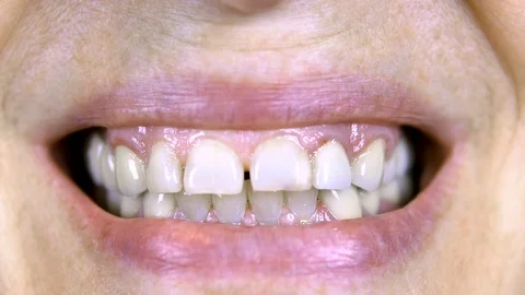 Show Teeth Posing Stock Videos – Royalty-Free HD & 4K Videos