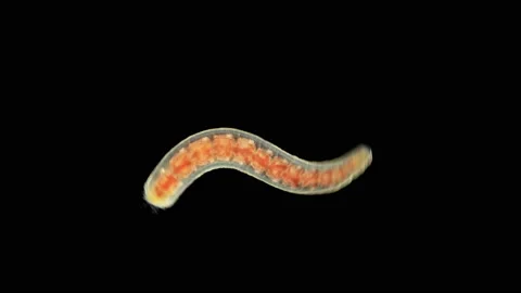 Oligochaeta worm under a microscope, typ... | Stock Video | Pond5