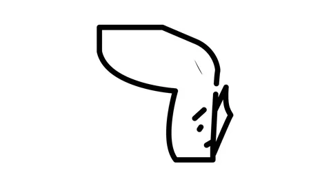 Open Bone Fracture Stock Videos – Royalty-Free HD & 4K Videos