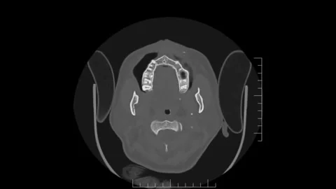 Ct Scan Isolated Stock Footage ~ Royalty Free Stock Videos | Pond5