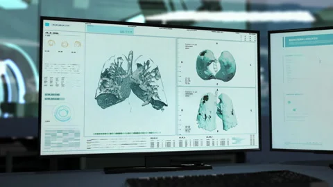 Cancer Projection Stock Footage ~ Royalty Free Stock Videos | Pond5