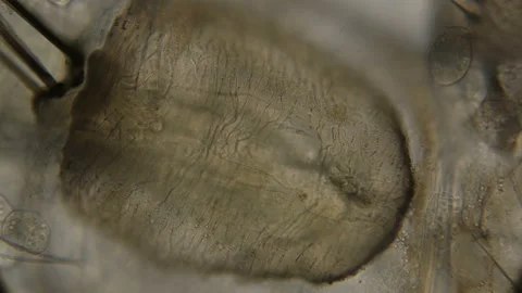 organs of a mosquito larva under a micro... | Stock Video | Pond5