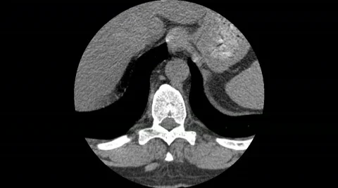 Original CT scan of human spine | Stock Video | Pond5