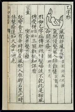 Paediatric finger diagnosis chart: Yi graph vein pattern Illustration ...