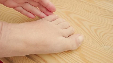 Painful moment as woman holds pinky toe,... | Stock Video | Pond5