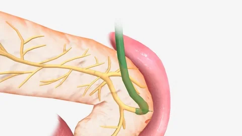 Pancreas Anatomy, Common bile duct | Stock Video | Pond5