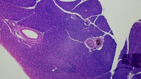 Biopsy Stock Footage ~ Royalty Free Stock Videos | Pond5