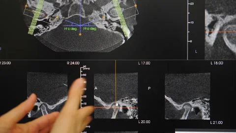 Panoramic dental x-ray. MRI scanning. Up... | Stock Video | Pond5