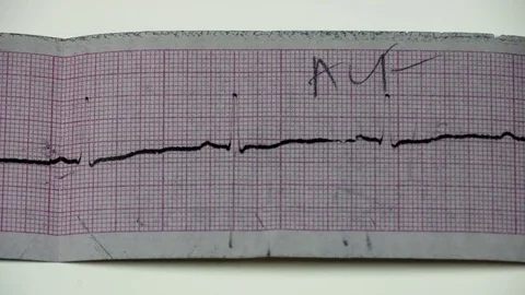 Cardiogram Paper Stock Footage ~ Royalty Free Stock Videos | Pond5