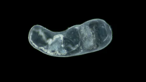Parasitic Trematoda worm under microscop... | Stock Video | Pond5