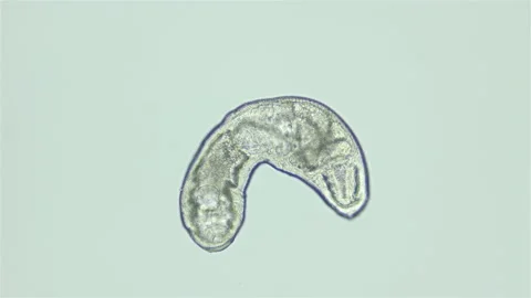 Parasitic Trematoda worm under microscop... | Stock Video | Pond5