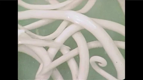 Parasitic worms infect children around t... | Stock Video | Pond5