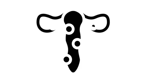 pathology of cervix glyph icon animation | Stock Video | Pond5
