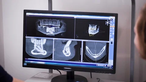 A Help Picture Stock Videos – Royalty-Free HD & 4K Videos