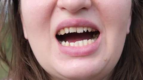 Temporomandibular Joint Stock Footage ~ Royalty Free Stock Videos | Pond5