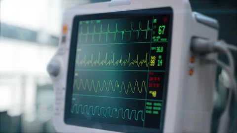 Patient monitor displays vital signs ECG... | Stock Video | Pond5