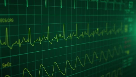 Patient monitor displays vital signs ECG... | Stock Video | Pond5