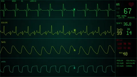 Patient monitor displays vital signs ECG... | Stock Video | Pond5